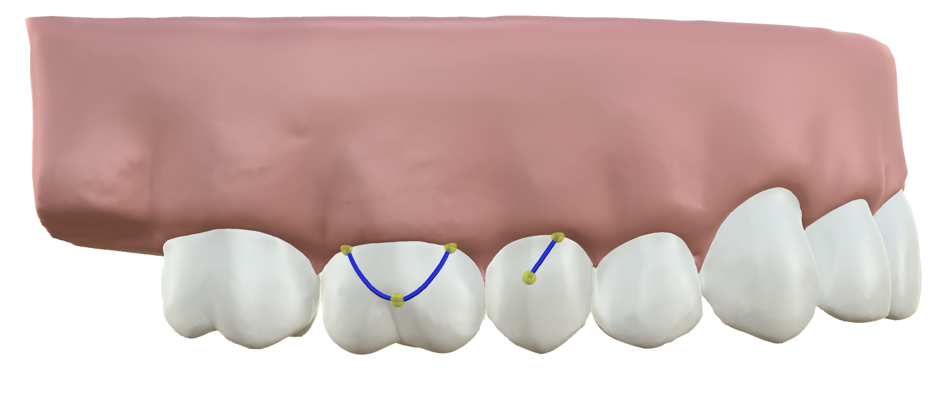 ArchForm - Simple, powerful 3D software to setup aligner cases